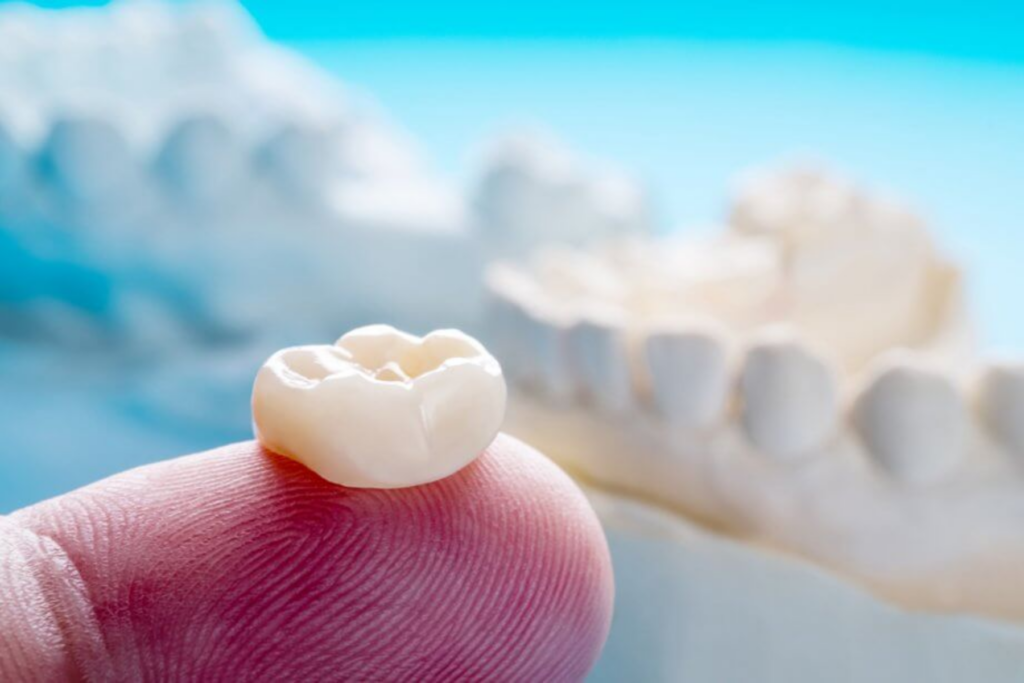 What To Do If Dental Crown Breaks
