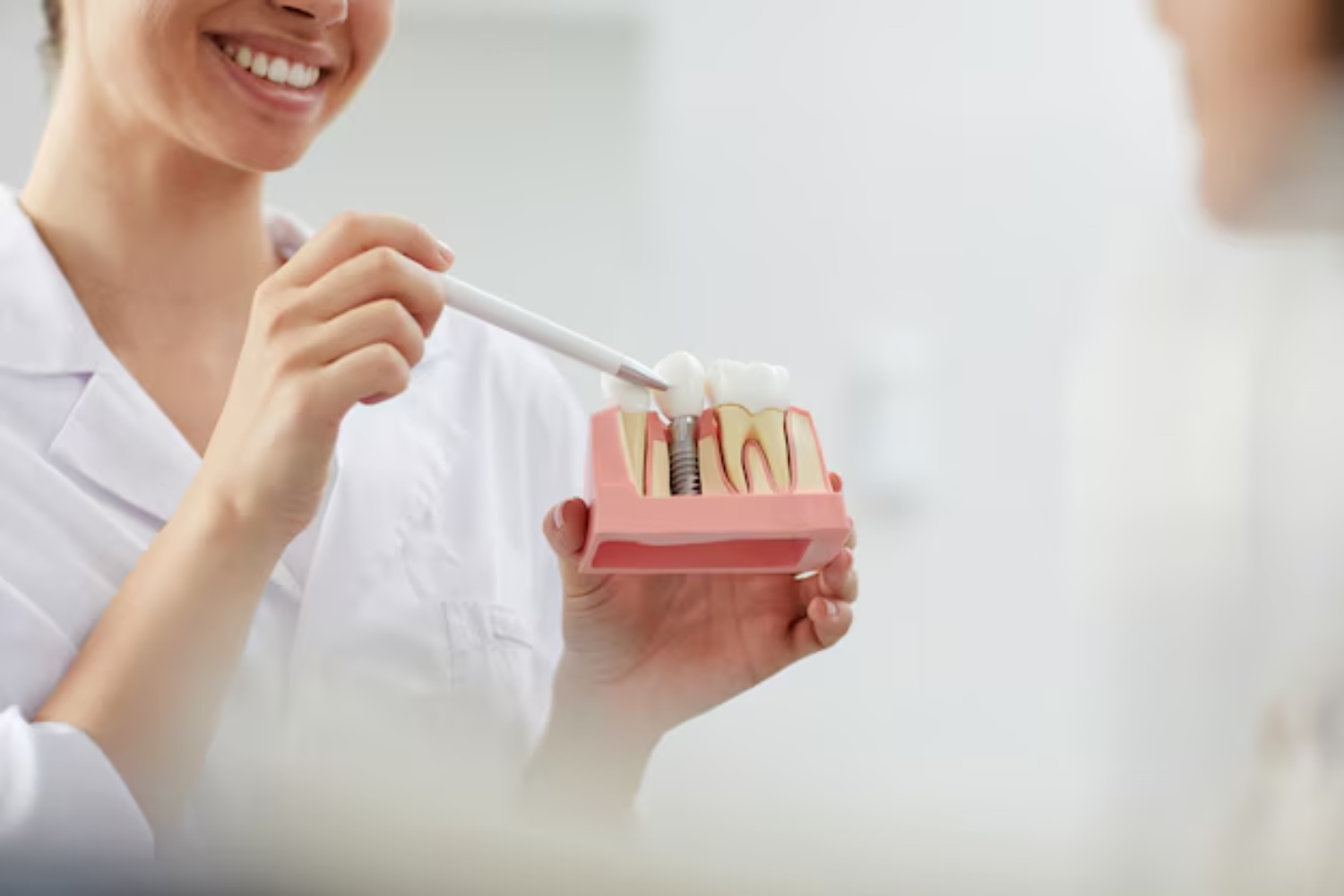 Why Dental Implants Are the Future of Tooth Replacement