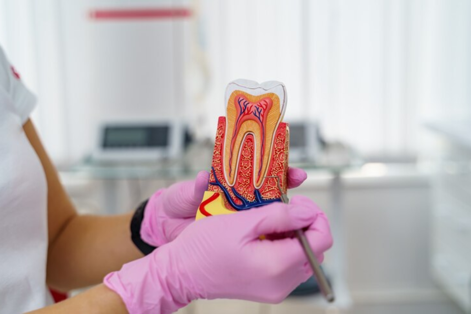 Root Canal Aftercare: 5 Effective Tips for a Speedy Recovery